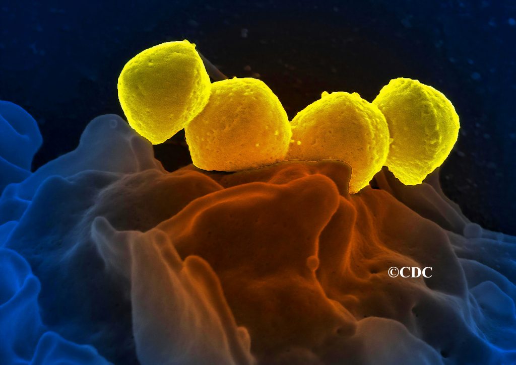 Isabelle de Cremoux (Seventure Partners) : « Le microbiote est le ...